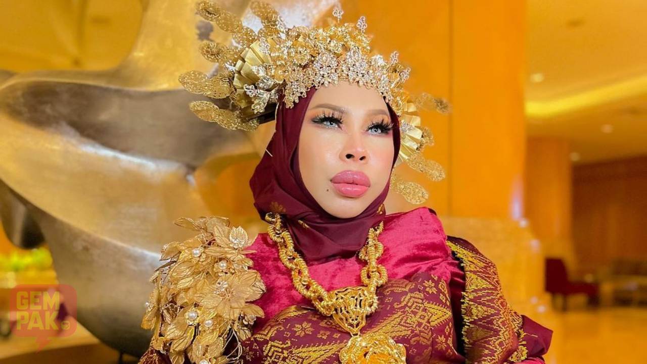 Pelik Kenapa Besar Sangat, Netizen Persoal Saiz Bibir Vida - “Bibir ...