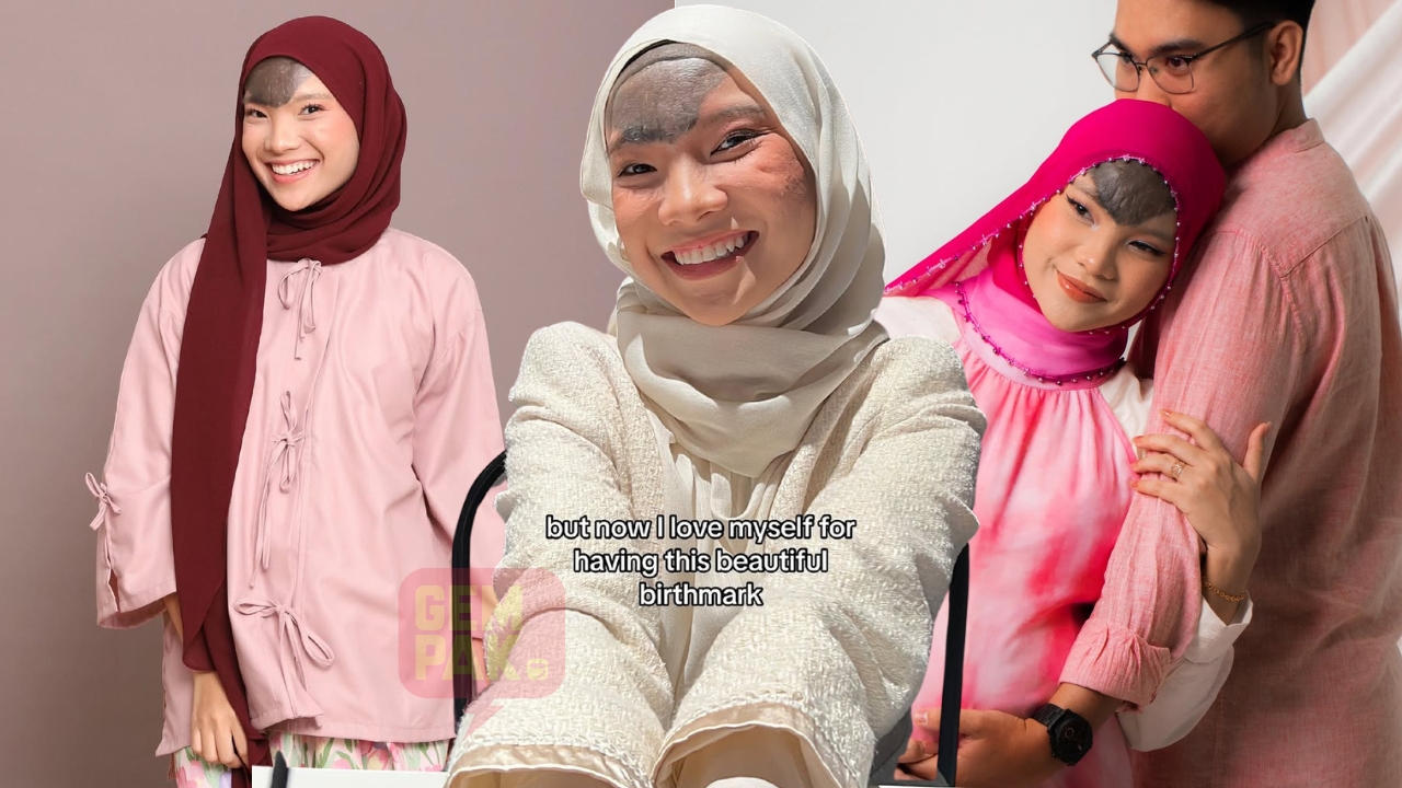 "Suami Tak Nak Cerai Ke?" - Syamimi Afrina Dihina Kerana Tanda Lahir di Dahi, Pilih Untuk Terus ...