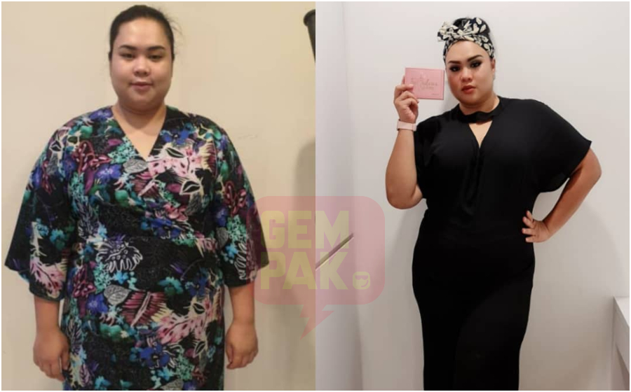 “Potong Usus? Hak Masing-Masing” - Vicha Ulas Isu ‘Anti Potong Usus ...