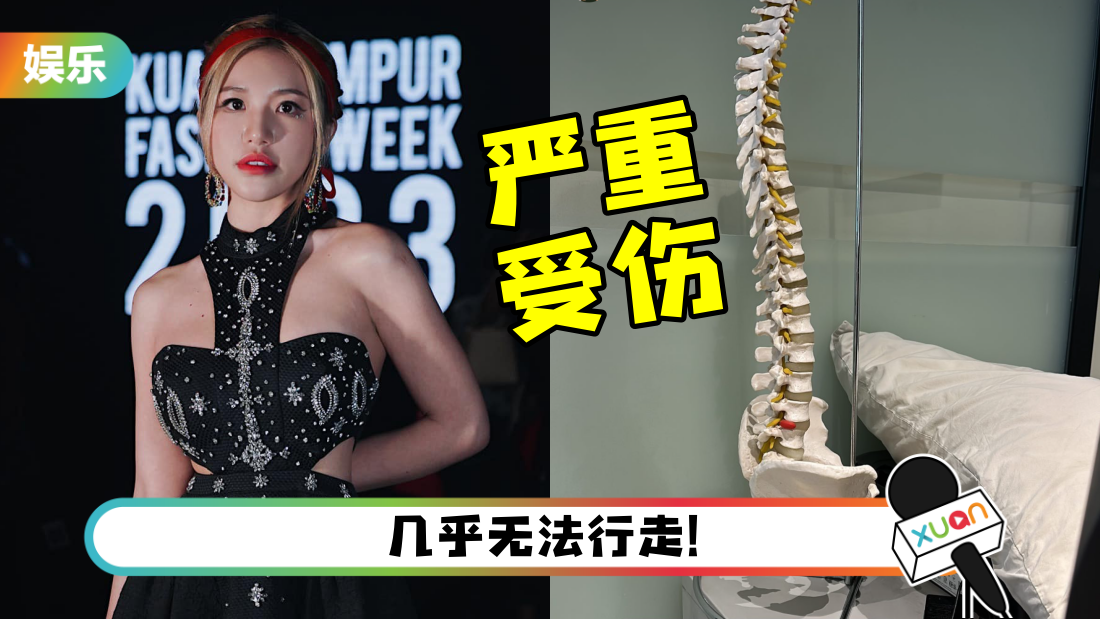 Ms Pui Yi 半夜发生意外…腰部严重受伤！4场表演全取消 | XUAN